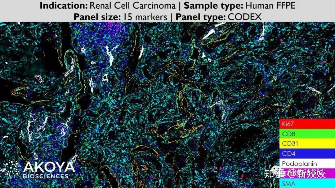 遇见CODEX|一文详解CODEX单细胞空间蛋白组学分析平台技术原理 - 知乎
