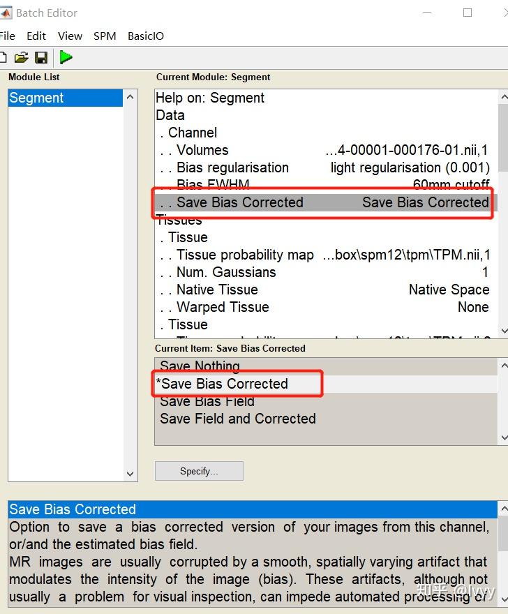SPM数据预处理 -单被试 - 知乎