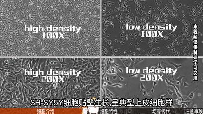 SH-SY5Y细胞培养，人神经母细胞瘤细胞培养攻略 - 知乎