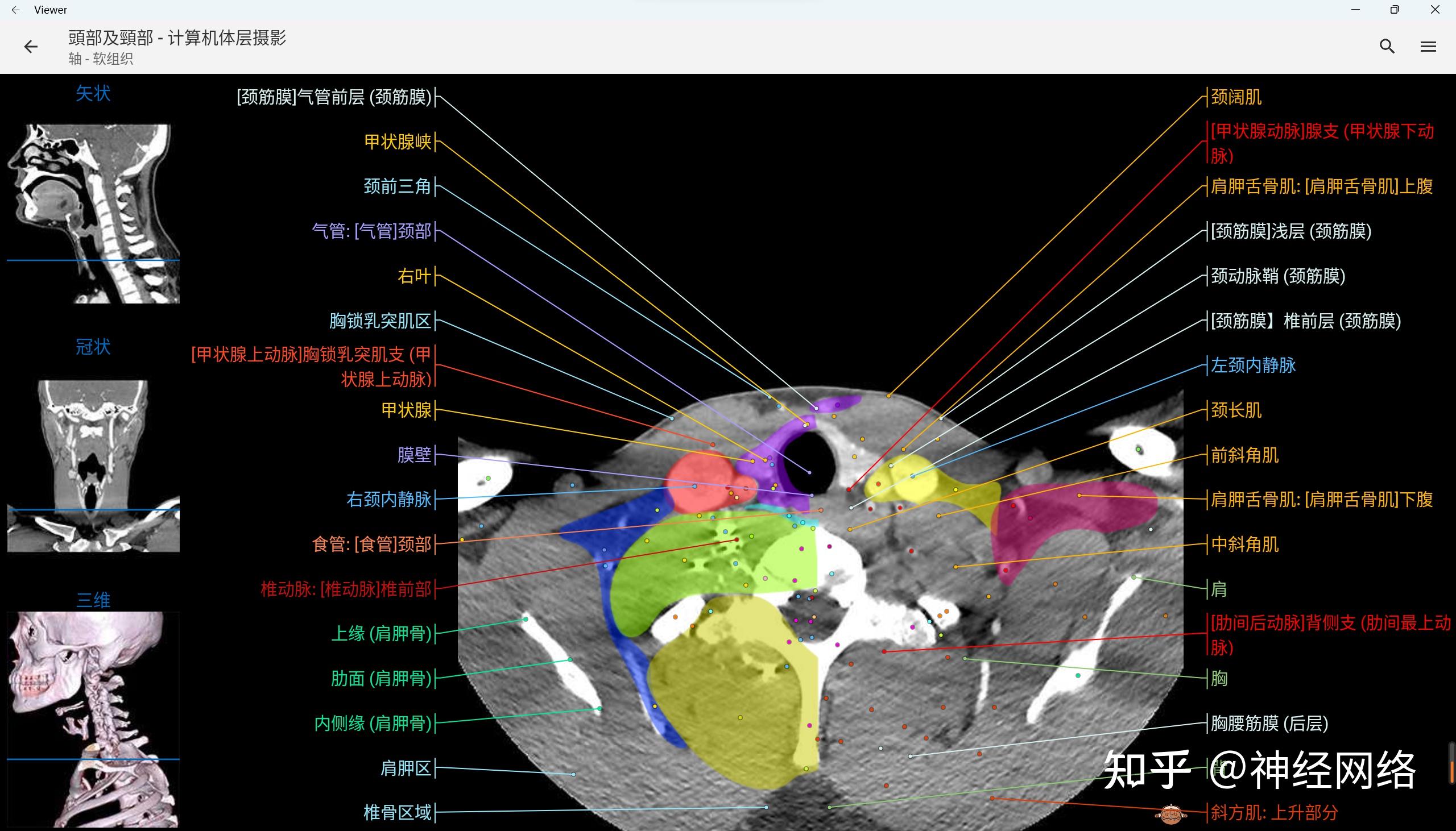 推荐一款超实用的影像软件工具 e-Anatomy（支持安卓、win11及Mac设备） - 知乎