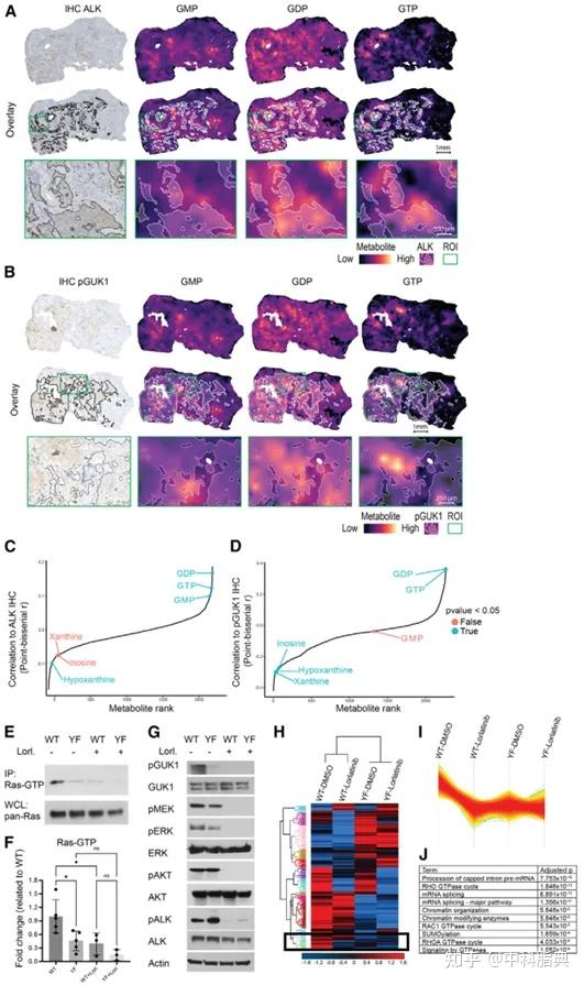 Cell：GUK1激活是肺癌的代谢关键点 - 知乎