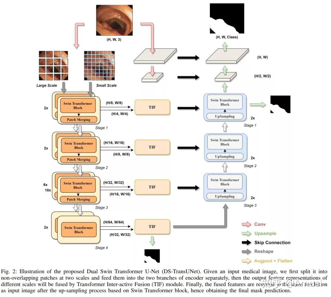 当Transformer遇见U-Net！ - 知乎