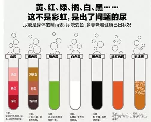 报告手把手教你读懂尿常规报告—智康体检 知乎
