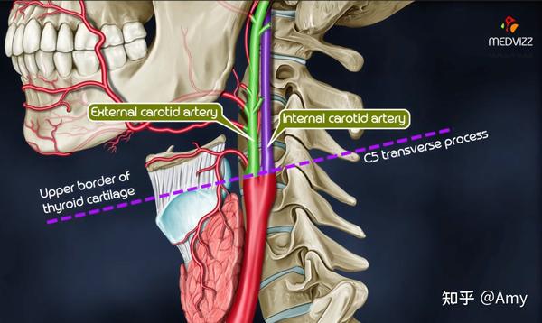 颈内动脉的8种分段系统 - 知乎