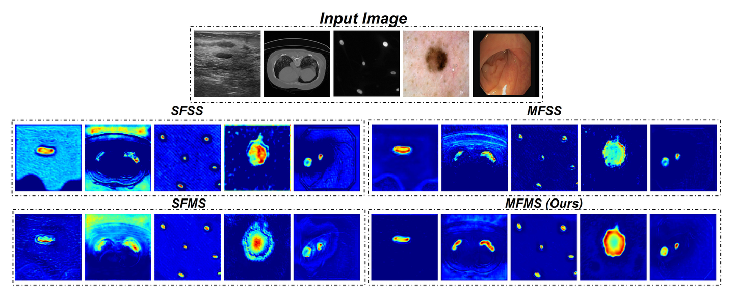 【CVPR2024】Generalizable Medical Image Segmentation by Multi-Frequency in Multi-Scale Attention - 知乎
