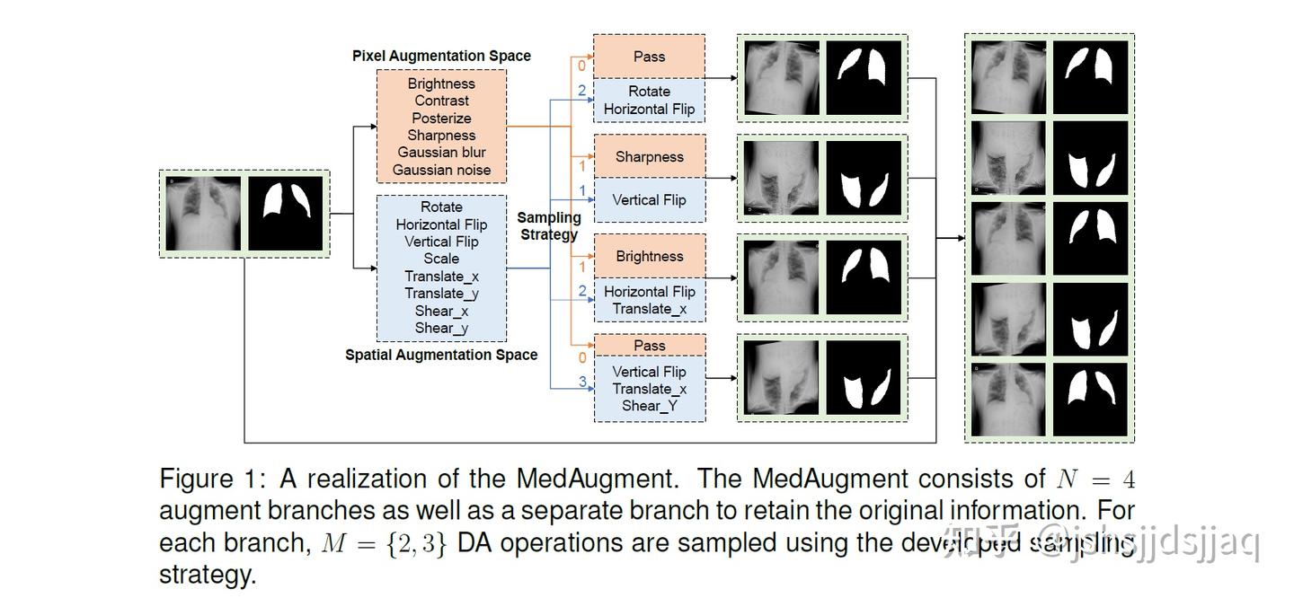 【ARXIV2306】MedAugment: Universal Automatic Data Augmentation Plug-in for Medical Image Analysis - 知乎