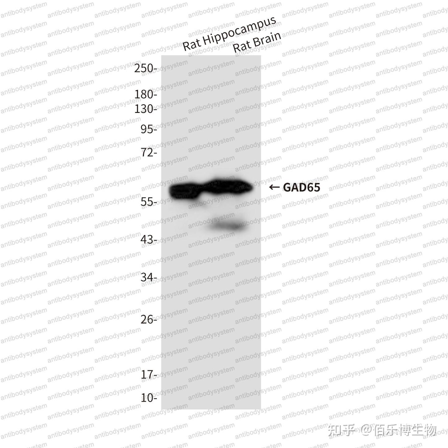 佰乐博生物蛋白抗体——GAD65（谷氨酸脱羧酶65） - 知乎