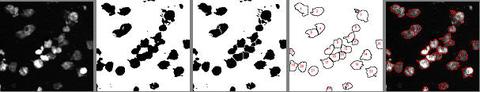 ImageJ使用心得之Particle Analysis （一） - 知乎