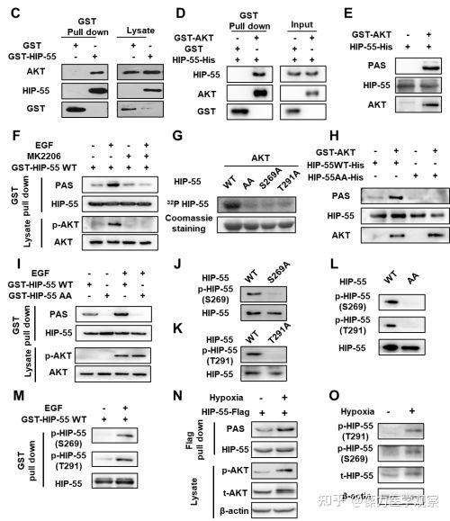 Cell Death & Differentiation：揭示心肌梗死铁死亡调控新机制 - 知乎